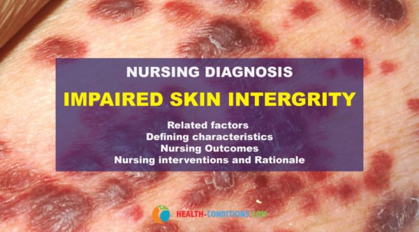 Impaired Skin Integrity - Nursing Care Plan & Nursing Diagnosis ...